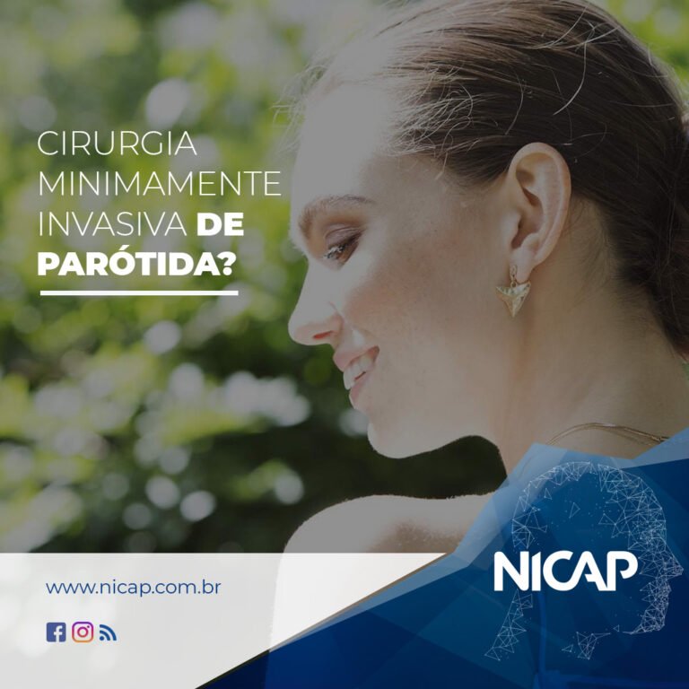 Cirurgia Minimamente Invasiva de Parótida? - NICAP